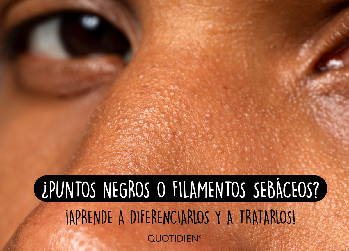 ¿Puntos negros o filamentos sebáceos? Aprende a diferenciarlos y ...